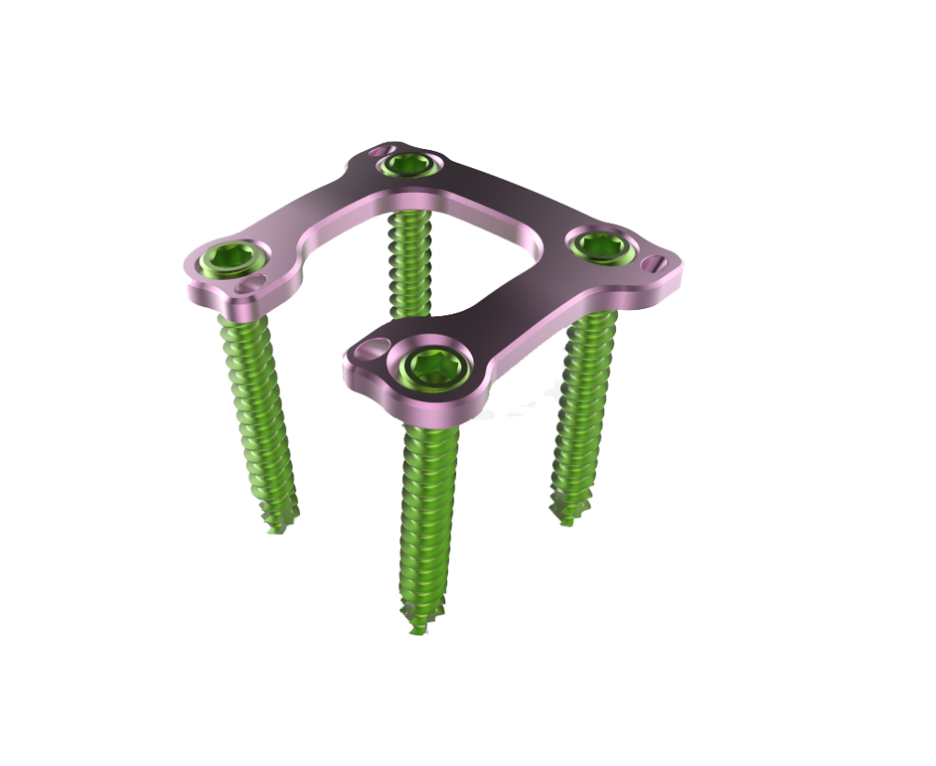 MetaFuse Midfoot/Lisfranc Plate | HNM Medical