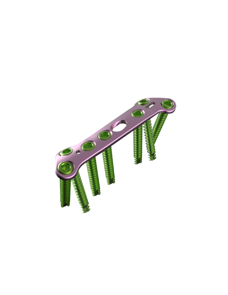 MetaFuse MTP-Plate | HNM Medical